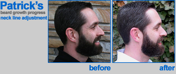 Patrick’s picture-perfect beard, a success story | All About BEARDS